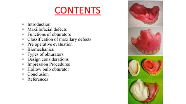 Obturators | PPTX | Dental Health | Diseases and Conditions
