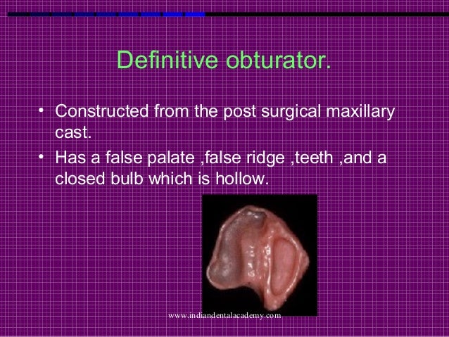 Obturator seminar final /orthodontic courses by Indian dental academy
