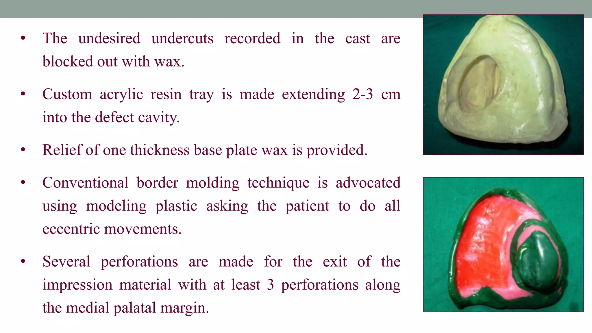 Obturators for acquired maxillary defects | PPTX