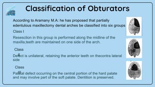 Brief discussion for Obturators used in Maxillofacial Rehabilitation ...