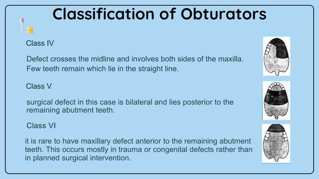 Brief discussion for Obturators used in Maxillofacial Rehabilitation ...