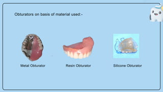 Brief discussion for Obturators used in Maxillofacial Rehabilitation ...