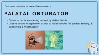 Brief discussion for Obturators used in Maxillofacial Rehabilitation ...