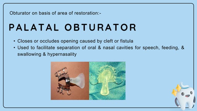 Brief discussion for Obturators used in Maxillofacial Rehabilitation ...
