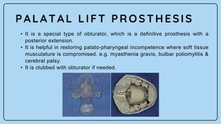 Brief discussion for Obturators used in Maxillofacial Rehabilitation ...