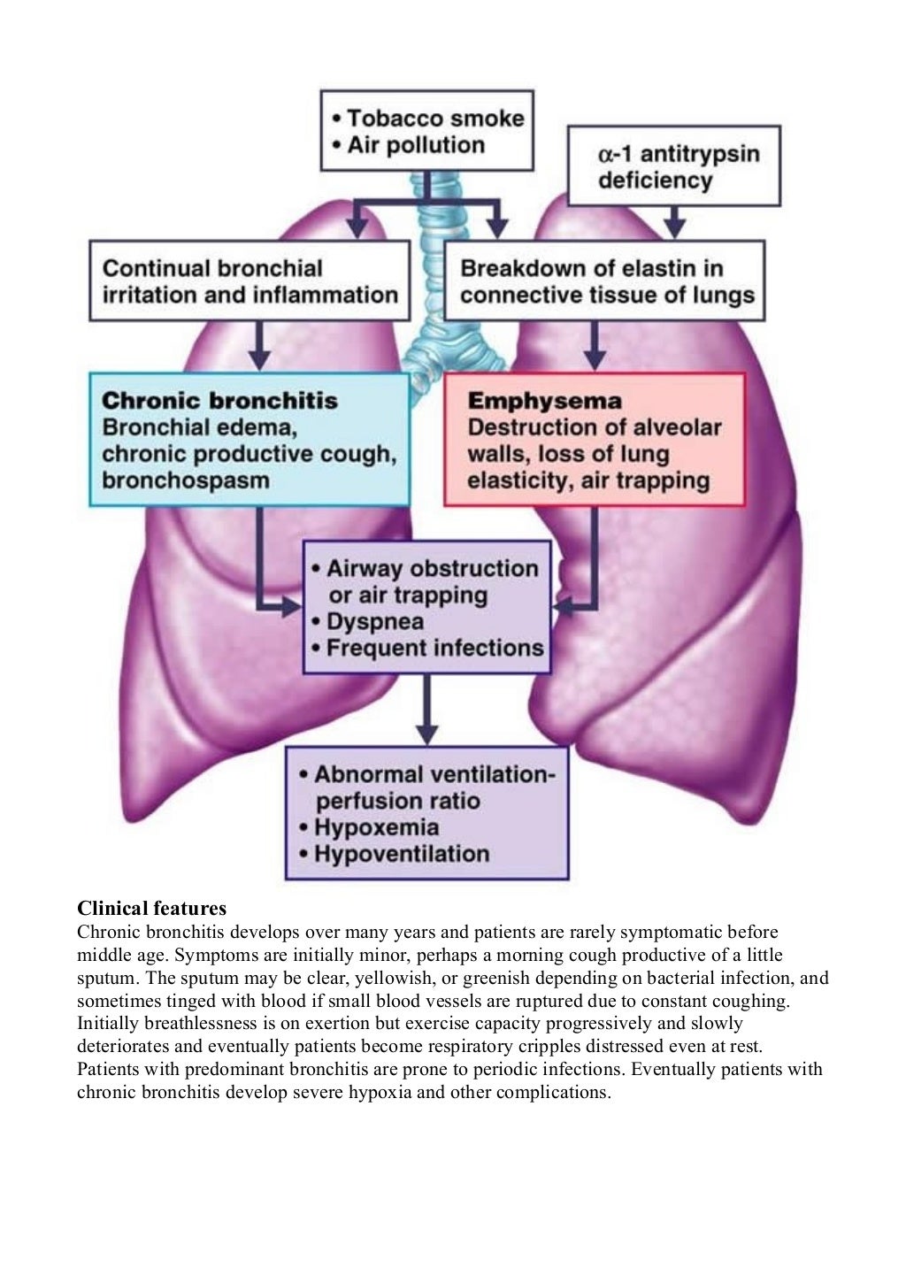 Chronic bronchitis
