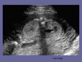 ULTRASOUND CASE REVIEW- BOARD REVIEW FOR DIAGNOSTIC RADIOLOGY | PPT
