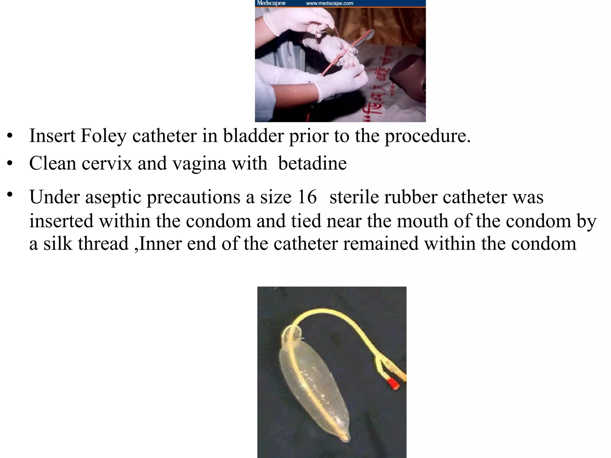 uterine vaginal balloons | PPT
