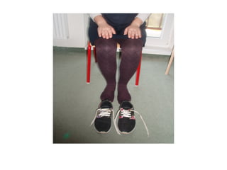 Putting on shoes - self care skill | PPT