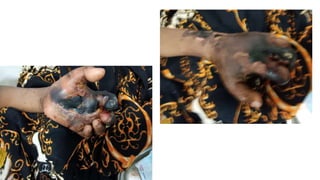 bisa_ular- oooooooooooooooooooooooo.pptx