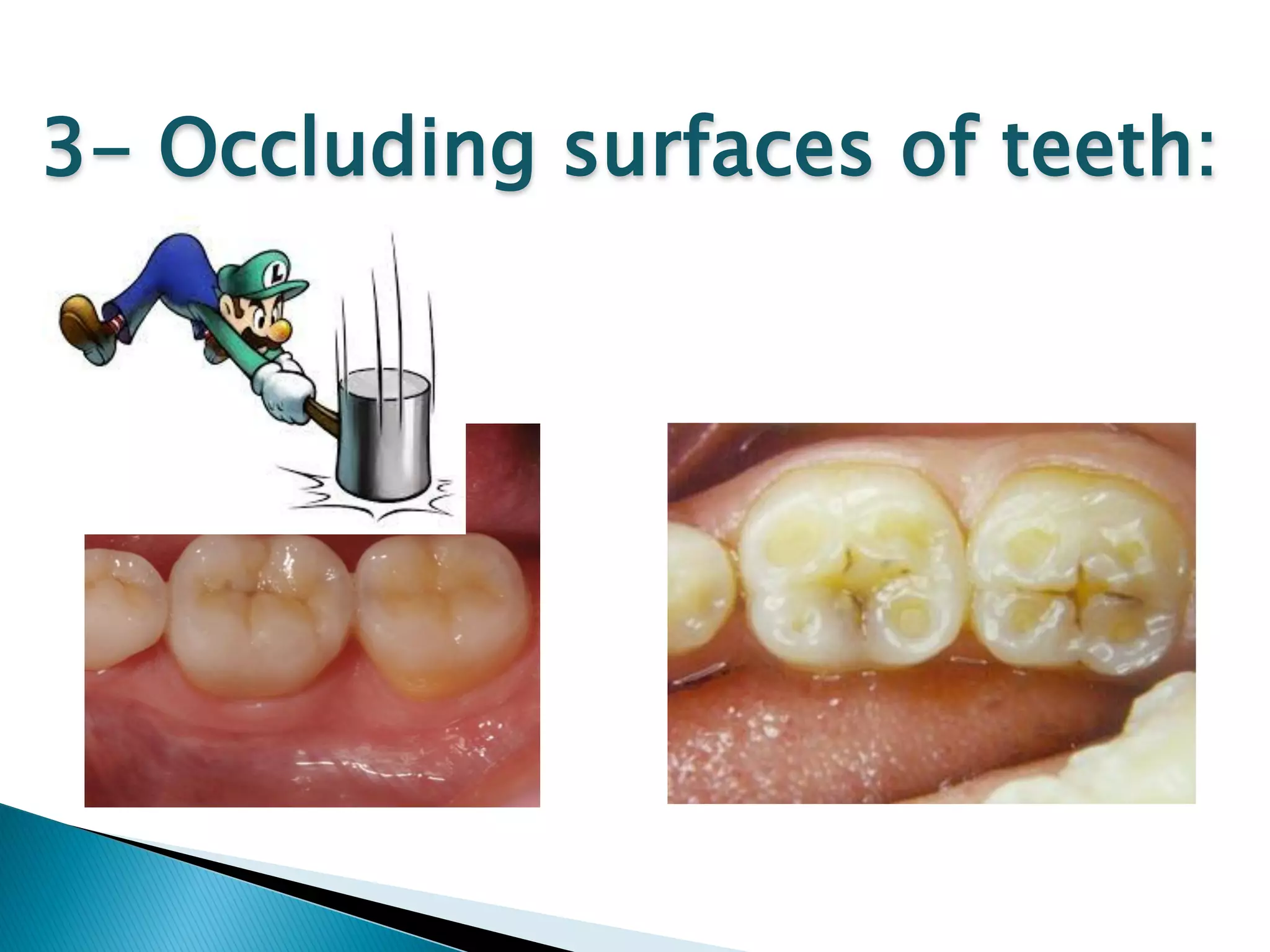 occlusal adjustment | PDF
