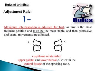 occlusal adjustment | PDF