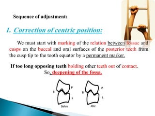 occlusal adjustment | PDF