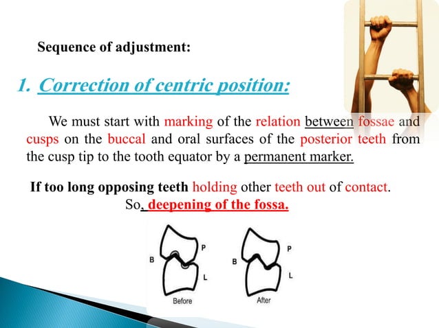 occlusal adjustment | PDF