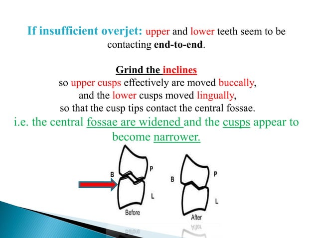 occlusal adjustment | PDF