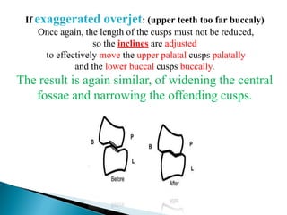 occlusal adjustment | PDF