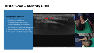 Occipital Neuralgia on Ultrasound: Greater Occipital Nerve Sonoanatomy ...