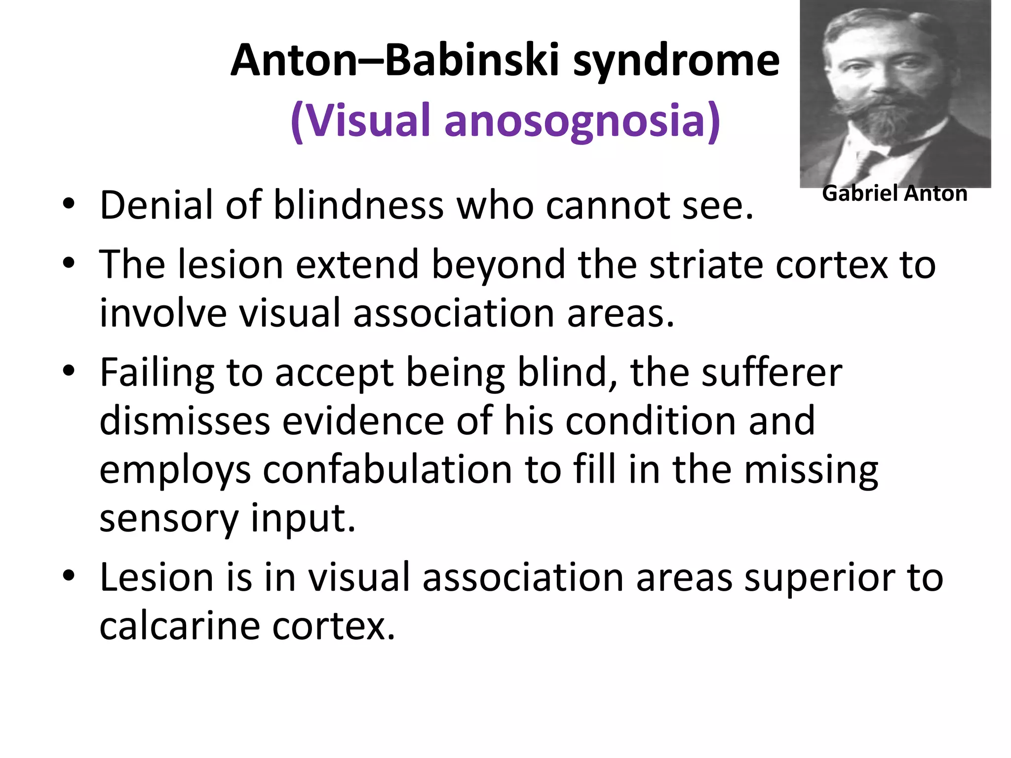 Occipital lobe 2 syndromes nwnw ppt | PPTX