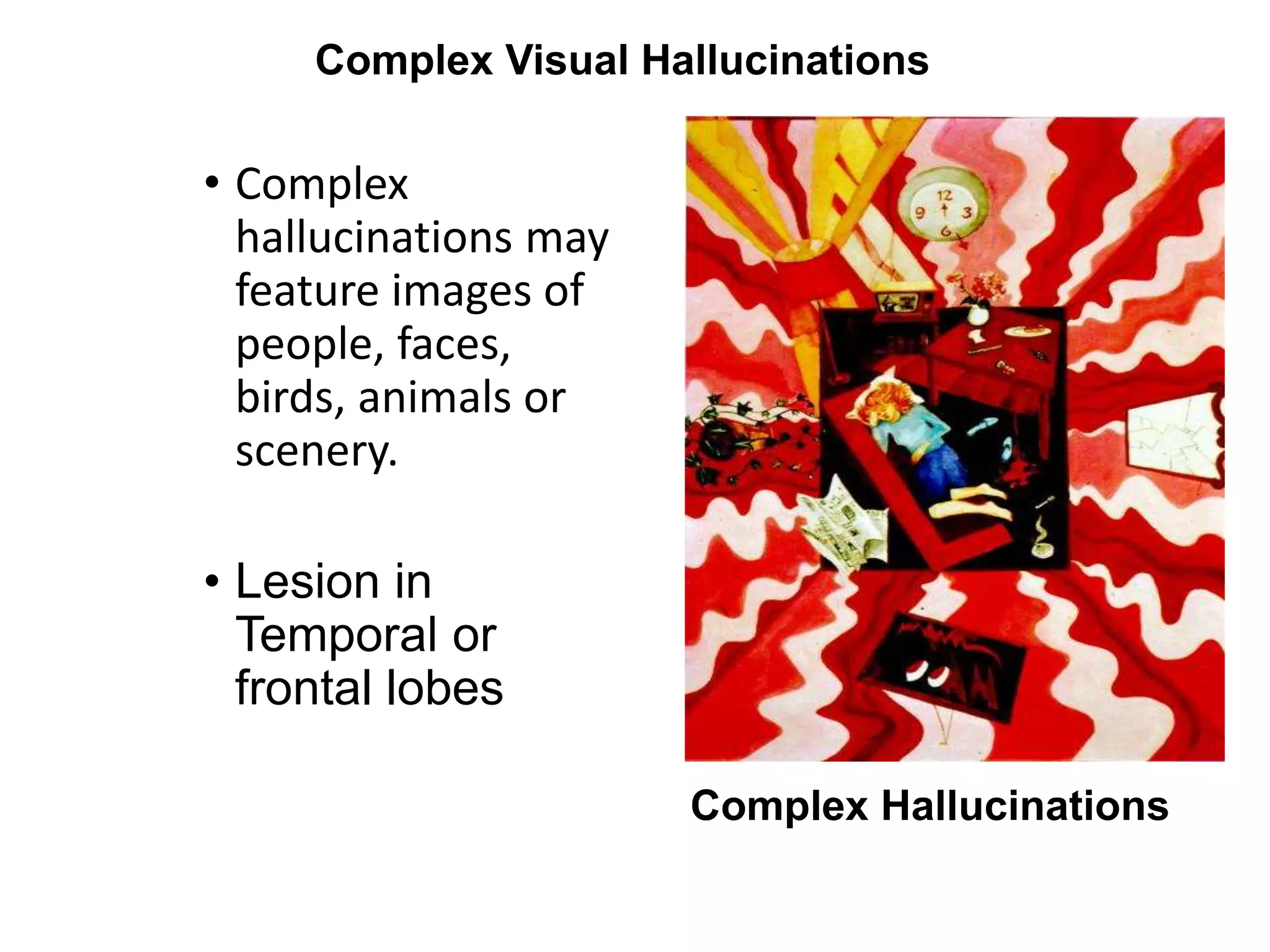 Occipital lobe 2 syndromes nwnw ppt | PPTX