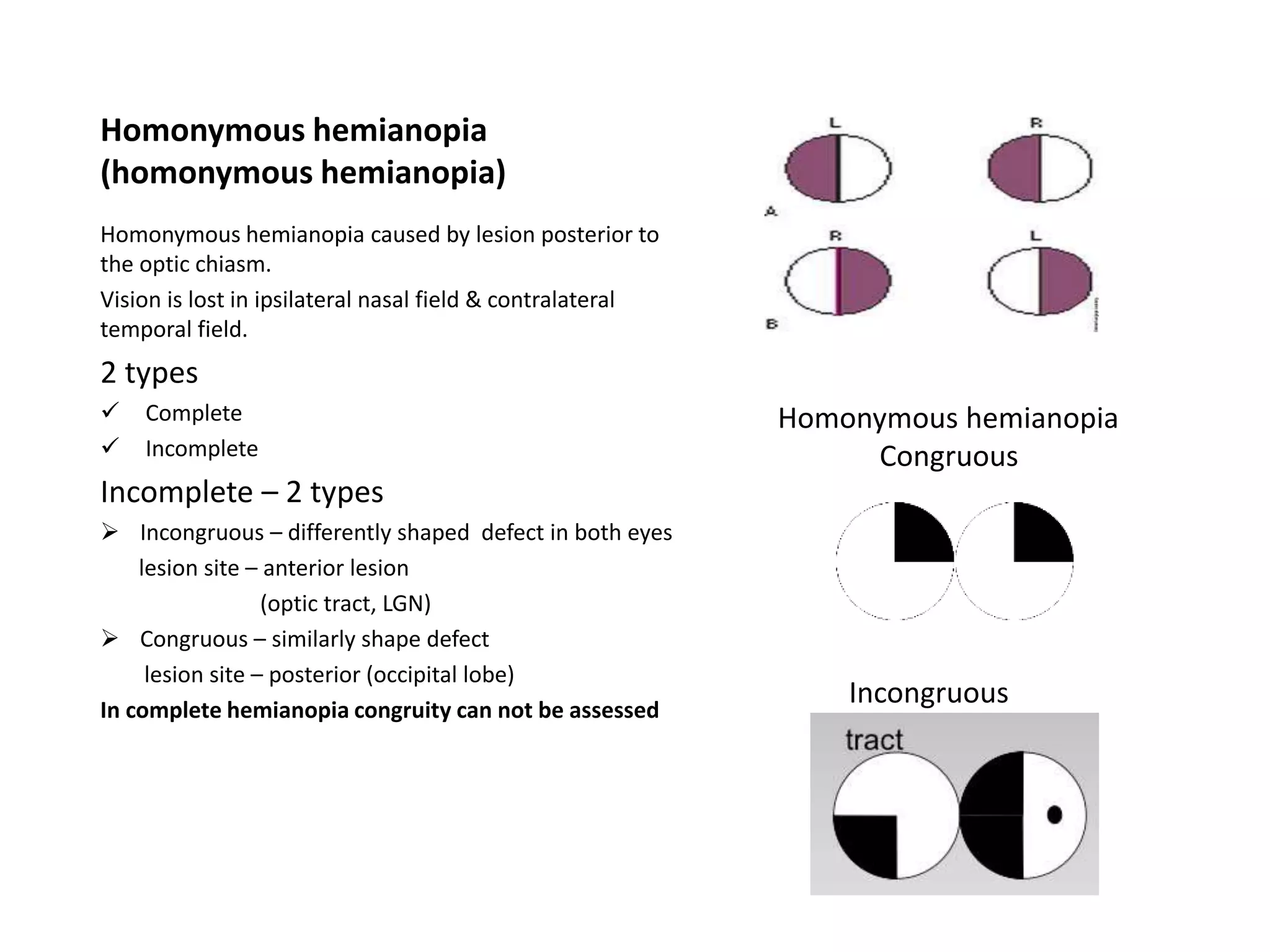 Occipital lobe 2 syndromes nwnw ppt | PPTX