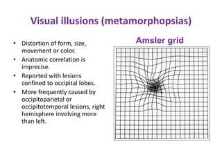Occipital lobe 2 syndromes nwnw ppt | PPTX