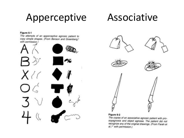 Occipital lobe 2 syndromes nwnw ppt