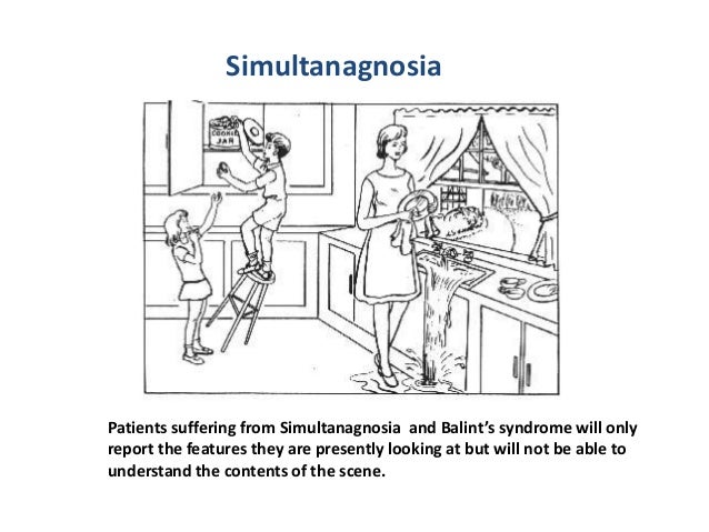 Occipital lobe 2 syndromes nwnw ppt