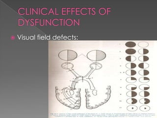 Occipital lobe and clinical effects of its dysfunction | PPTX