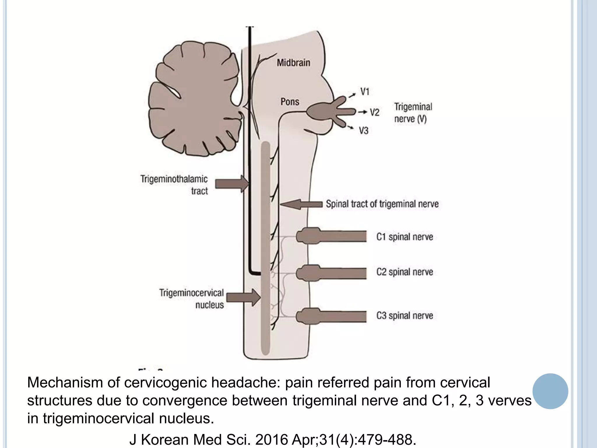 Occipital Neuralgia | PPTX
