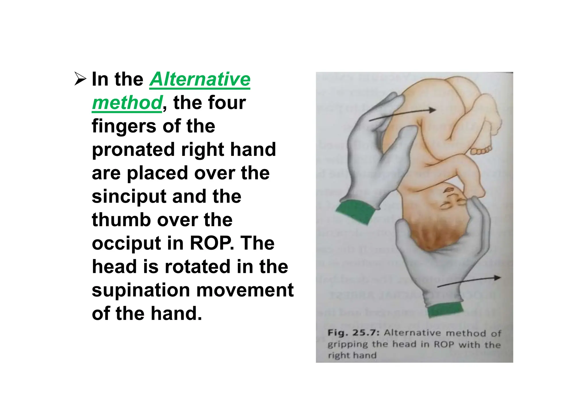 Occipital posterior position .pdf 🙏🙏🙏 | PDF