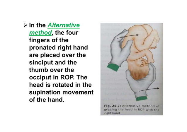 Occipital posterior position .pdf 🙏🙏🙏 | PPT