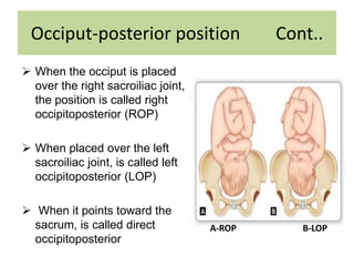 Occipito posterior position | PPTX | Pregnancy | Reproductive Health