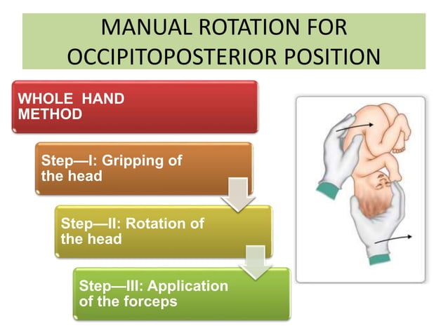 Occipito posterior position | PPTX | Pregnancy | Reproductive Health