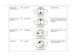 Occipito posterior position | PPTX