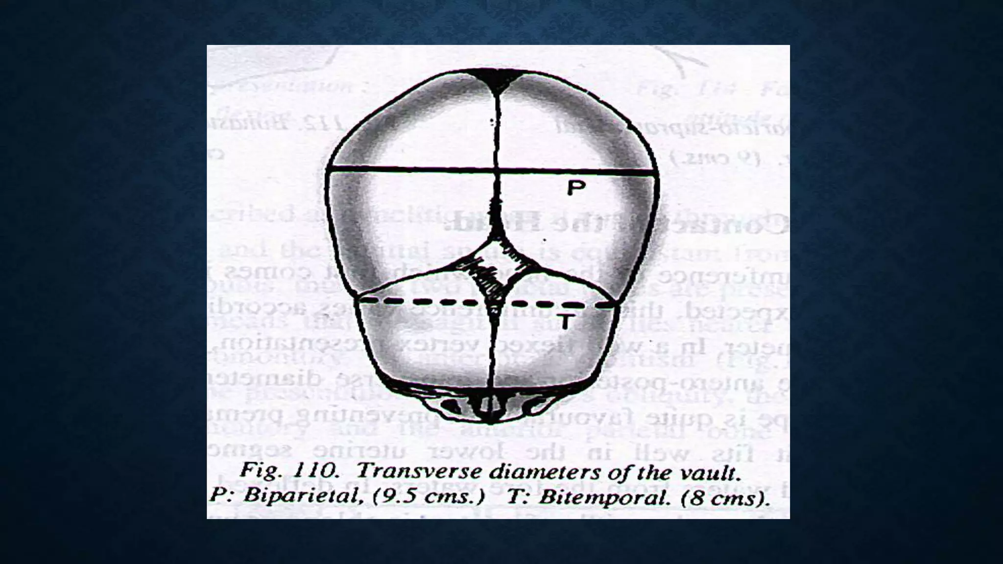 occipito posterior and shoulder presentation.pptx