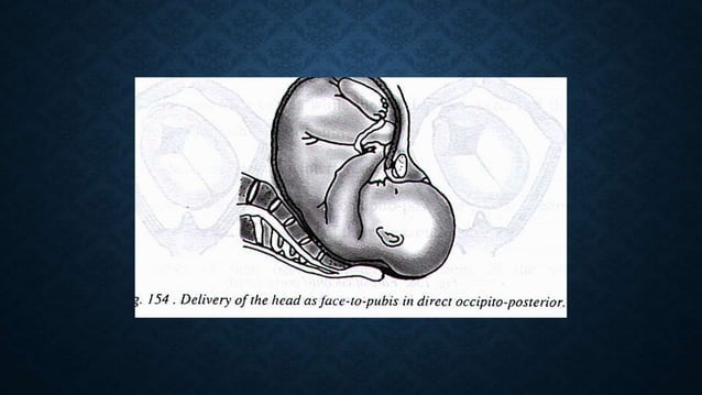 occipito posterior and shoulder presentation.pptx