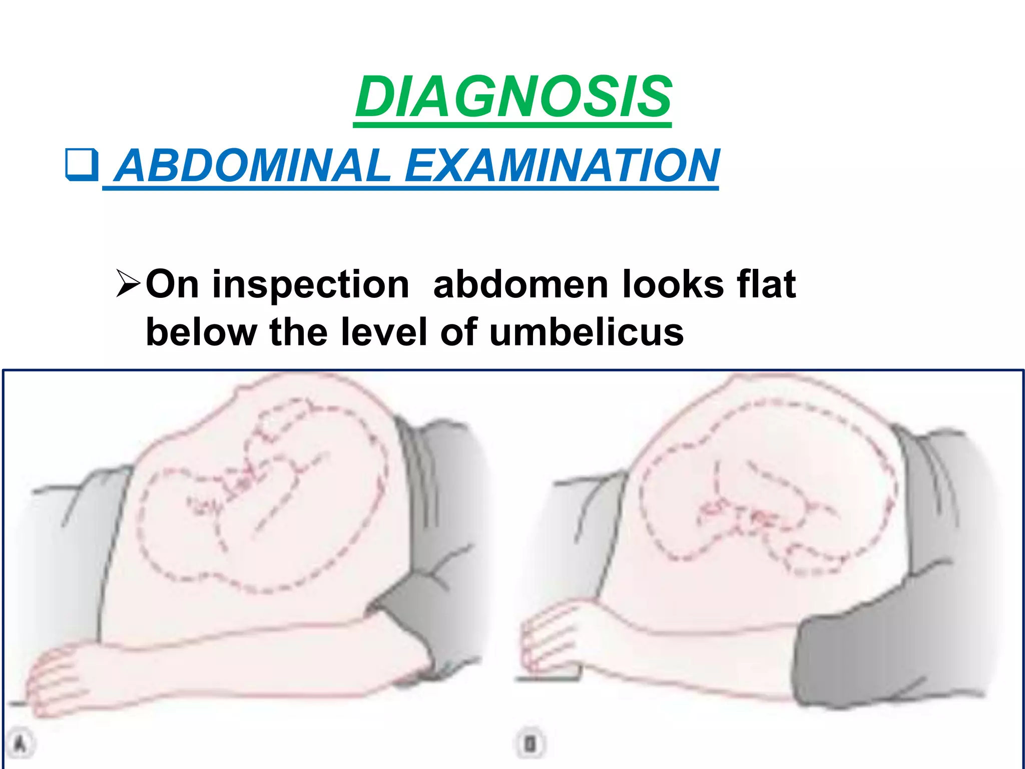 Occipito posterior position | PPTX