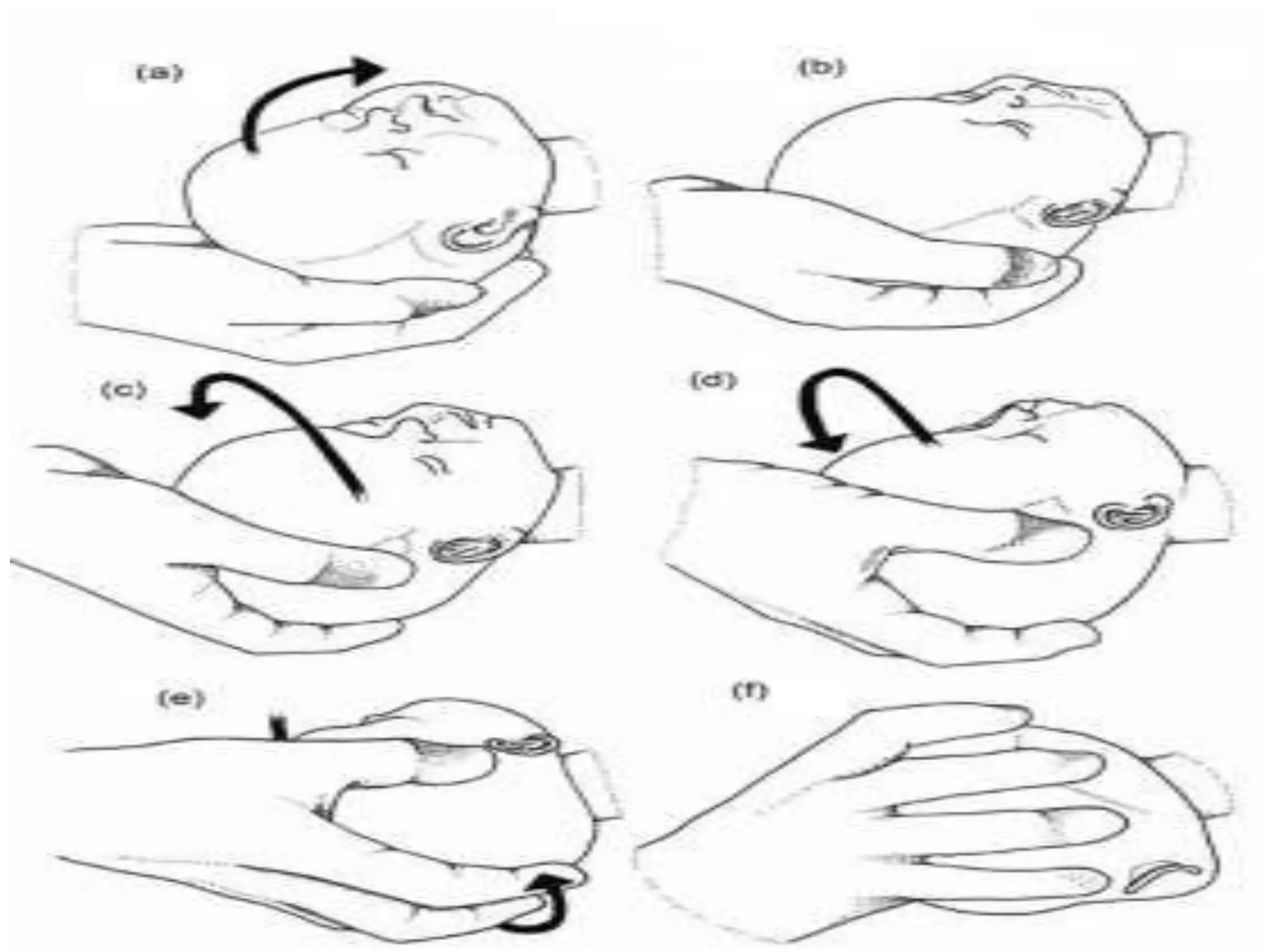 Occipito posterior position | PPTX