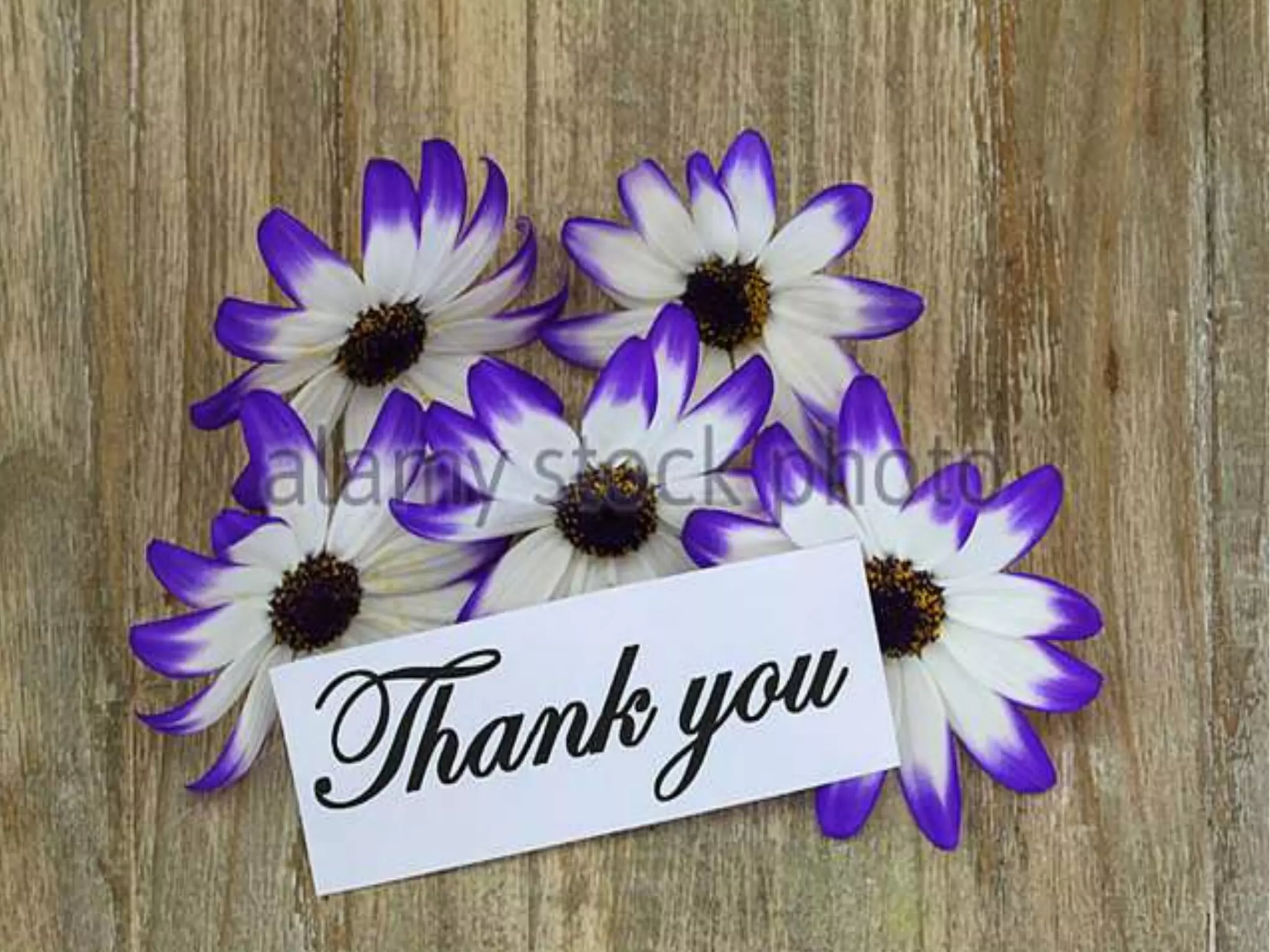 Occipito posterior position | PPTX