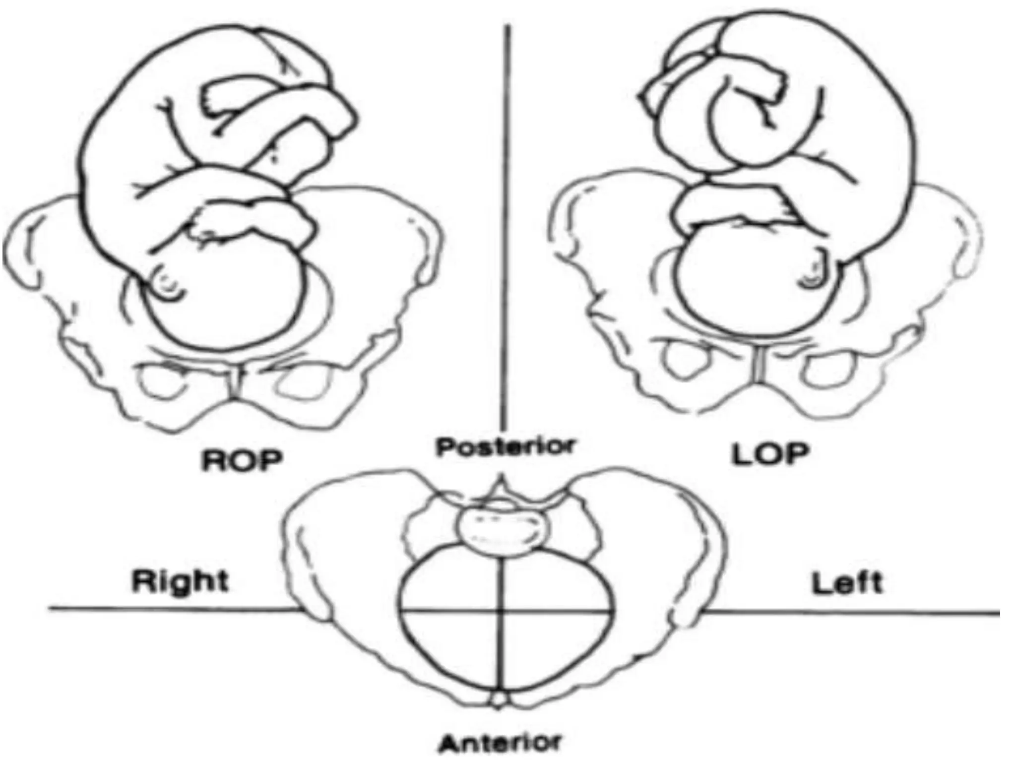 Occipito posterior position | PPTX