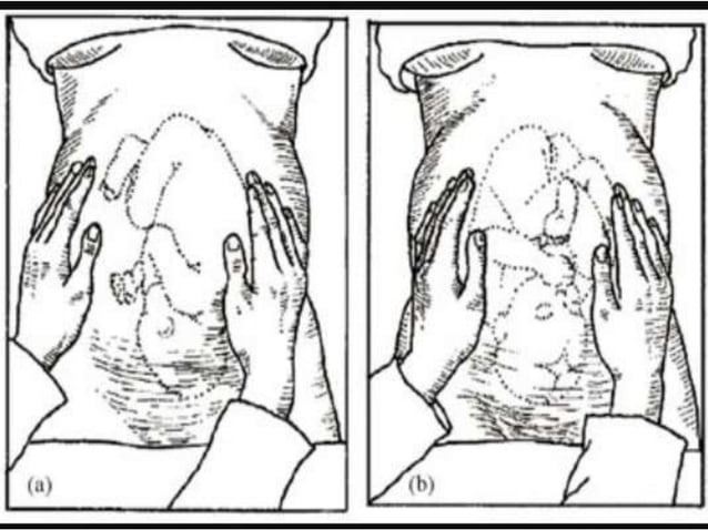 Occipito posterior position | PPTX