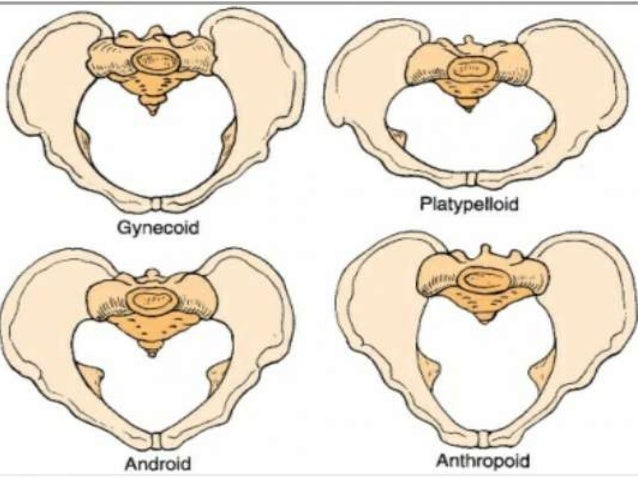 Occipito posterior position