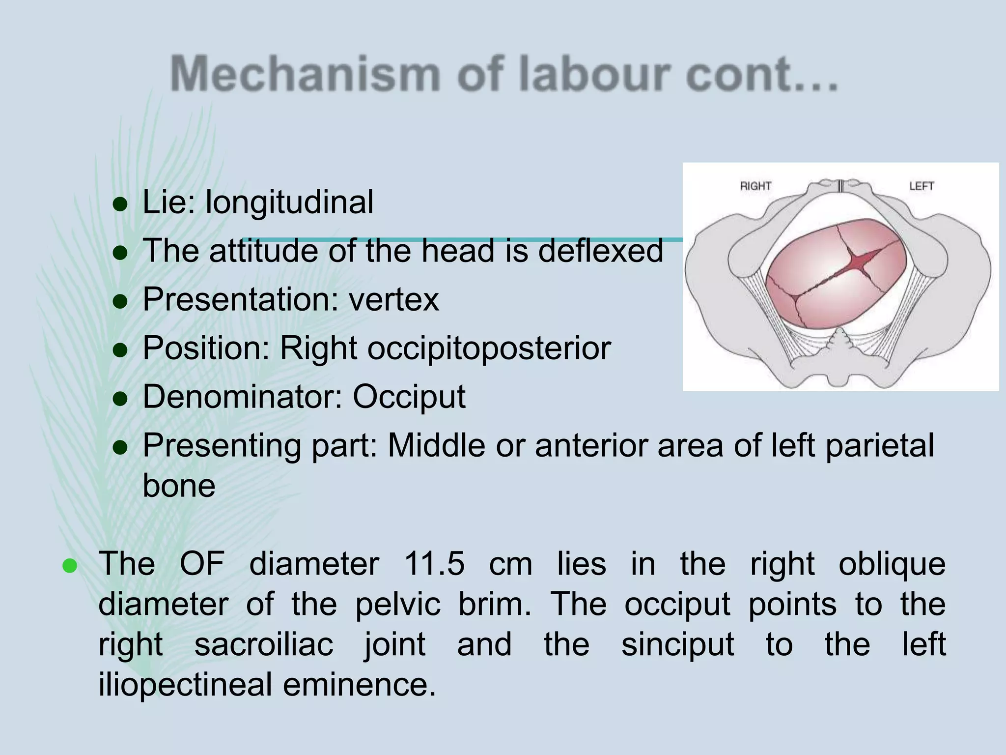 Occipito posterior position | PPTX