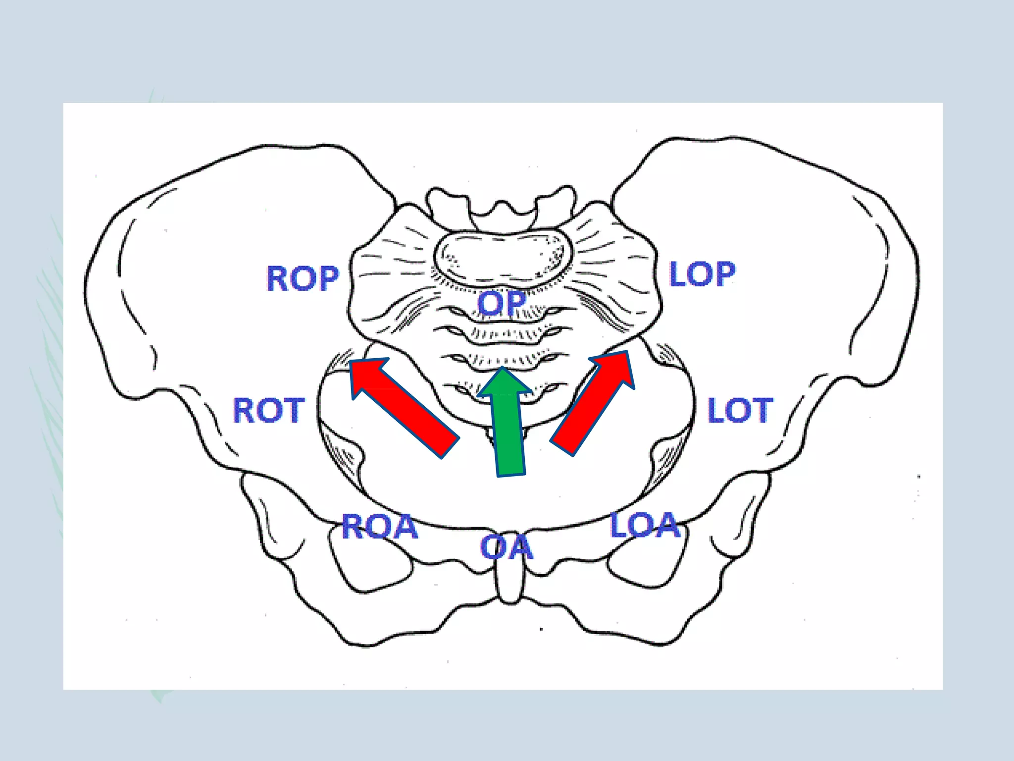 Occipito posterior position | PPTX