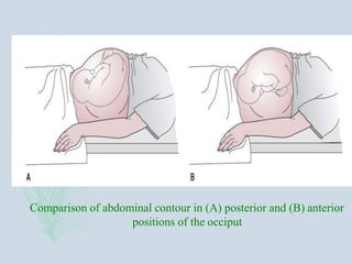 Contour Position Nursing