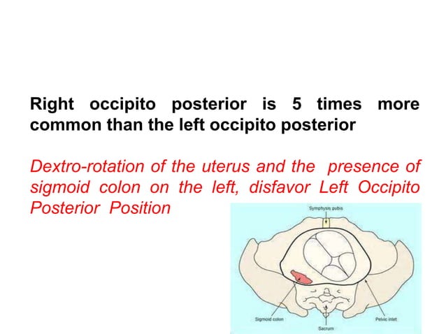occipitoposteriorposition.pptx