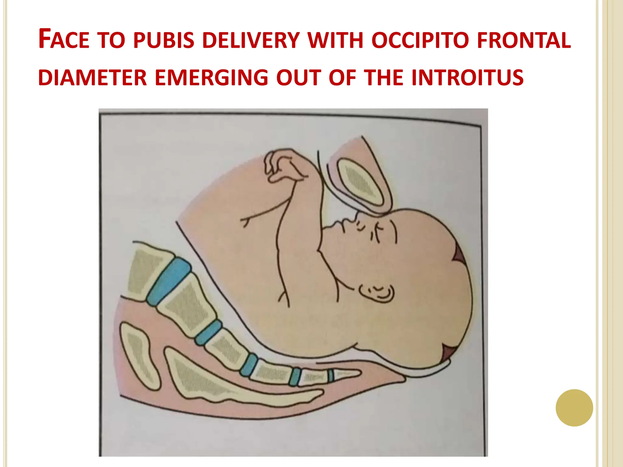 Occipito posterior position 20.06.2020 final.ppt