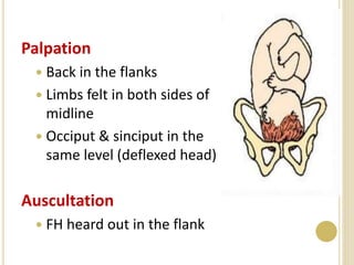 Occipito posterior position 20.06.2020 final.ppt
