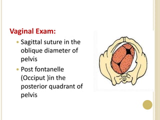 Occipito posterior position 20.06.2020 final.ppt