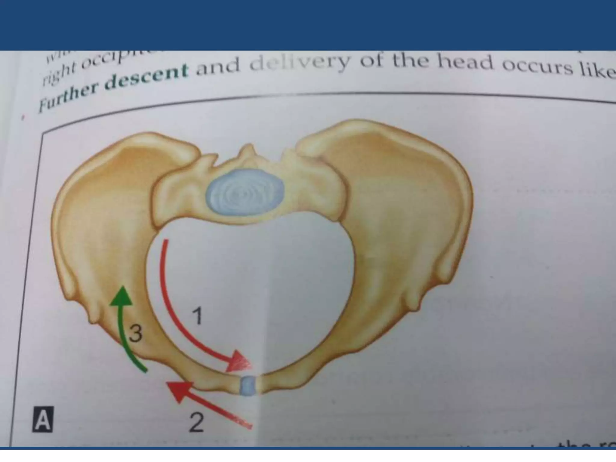 Occipito posterior position | PPT